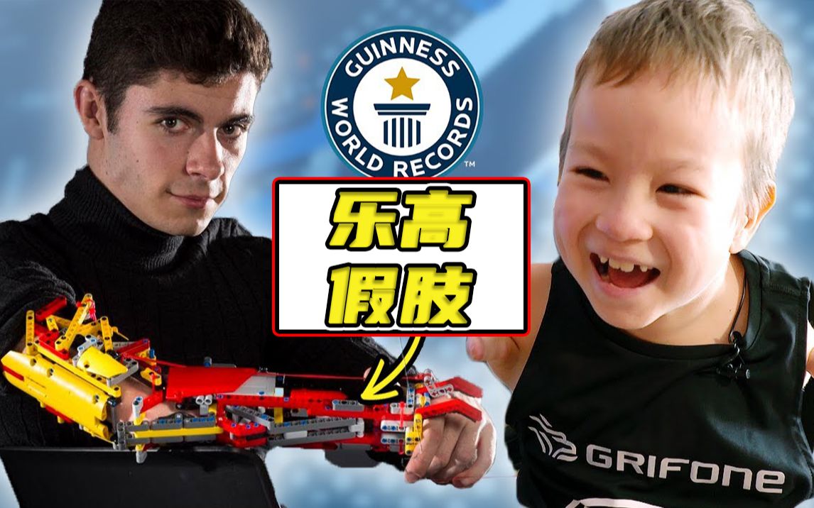 Born Strong: The Boy Building LEGO Prosthetics for Kids with Mobility ...