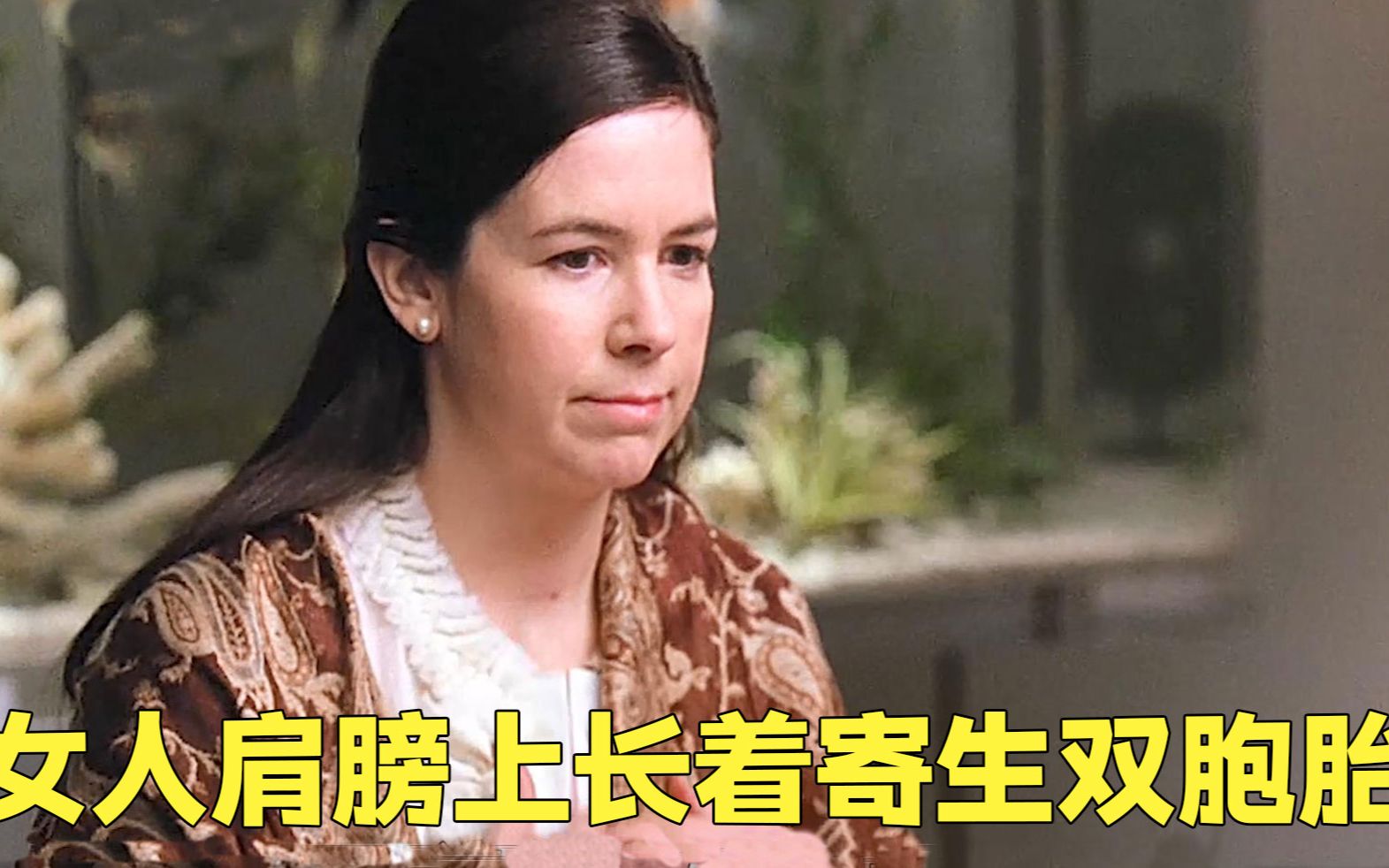 Di bahu wanita itu tumbuh seorang adik kembar parasit. - Bstation