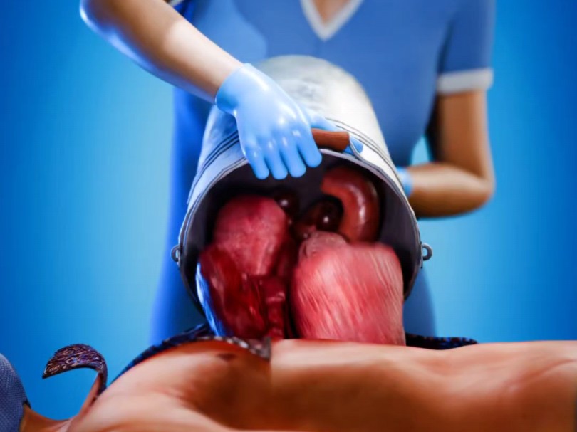 What Does a Postmortem Examination Look Like? - BiliBili