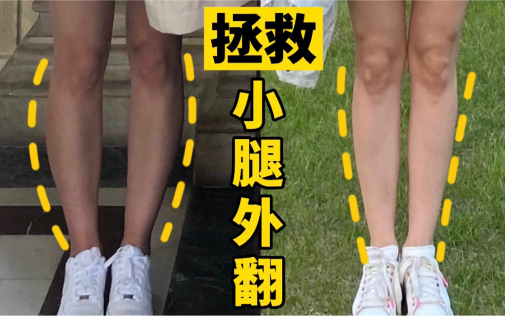 These 6 moves really work! If your calves turn outward, there’s hope ...